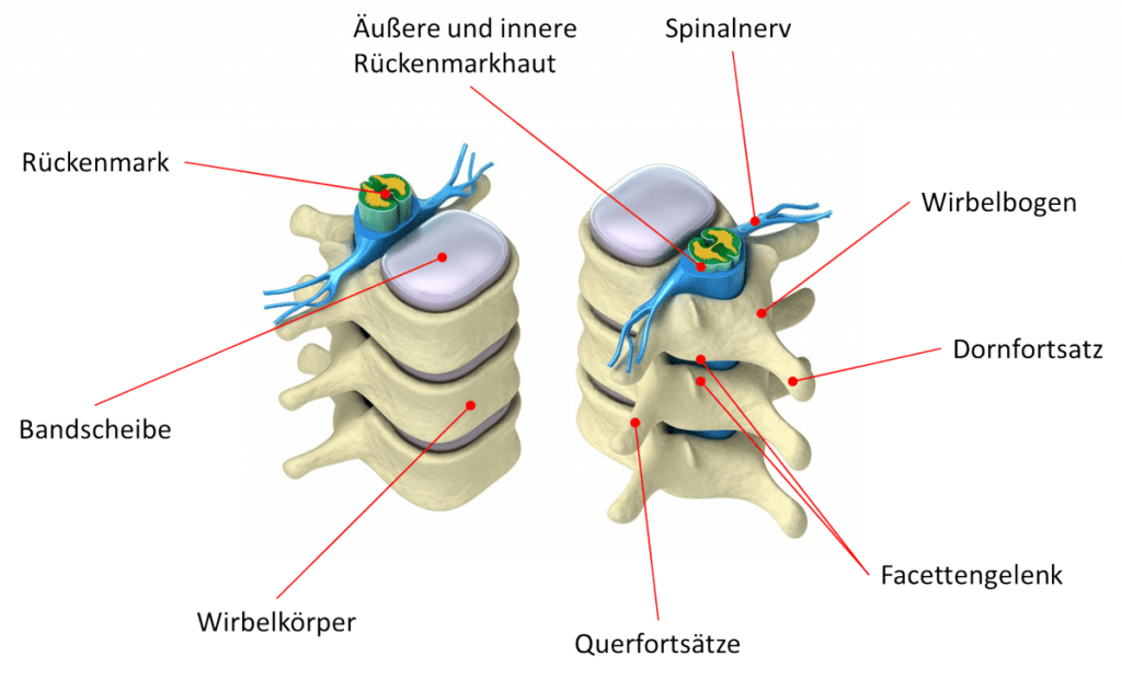 Morbus Scheuermann: Symptome, Ursachen, Therapie | backlaxx®