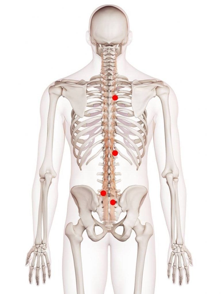 Triggerpunkte: Übersicht, Symptome und Ursachen | BACKLAXX®